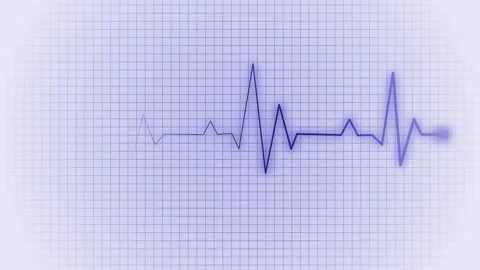 Electrocardiogram Background Stock Video Footage | Royalty Free ...