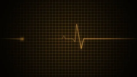 ECG Line on Dark Grid Animation, Electro... | Stock Video | Pond5