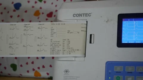 ECG machine display and print out chart ... | Stock Video | Pond5