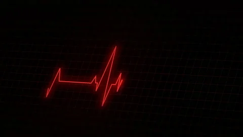 ECG Medical Heartbeat Pulsation Backgrou... | Stock Video | Pond5