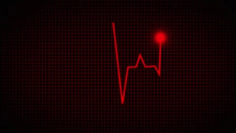 ECG monitor and heartbeat line. An anima... | Stock Video | Pond5