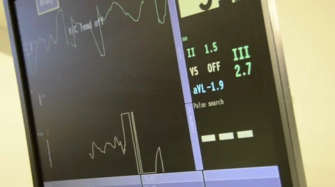 ECG monitor in emergency room Hospital, ... | Stock Video | Pond5