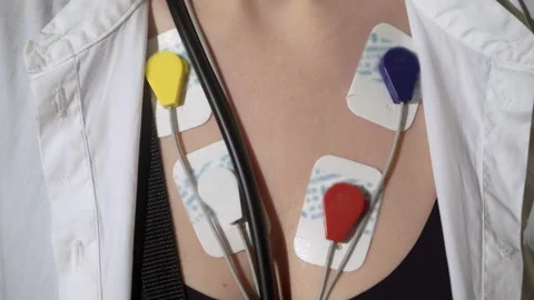 ECG sensors, electrocardiogram and blood... | Stock Video | Pond5