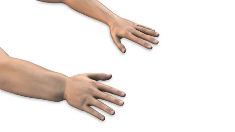 Edema swollen hand or arm lymphedema dis... | Stock Video | Pond5