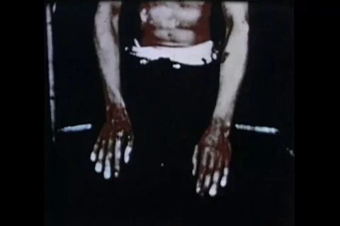 Effects of nuclear explosions on human b... | Stock Video | Pond5