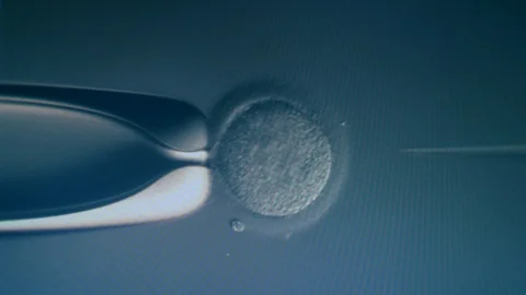 Egg cell is getting fertilized under a m... | Stock Video | Pond5