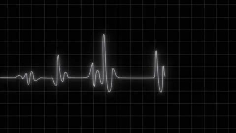Loop Ready Background Ekg Supercharging The ECG: AI Set To