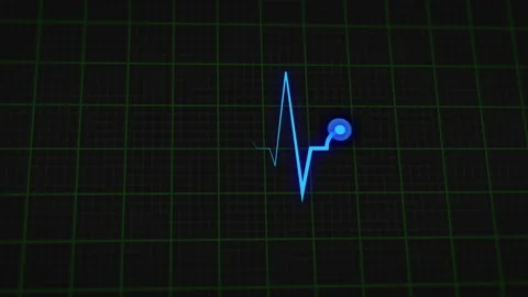 EKG, Blue. Heart rate monitor. Electroca... | Stock Video | Pond5
