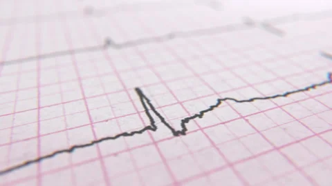 Ekg Graph Paper Stock Video Footage | Royalty Free Ekg Graph Paper ...