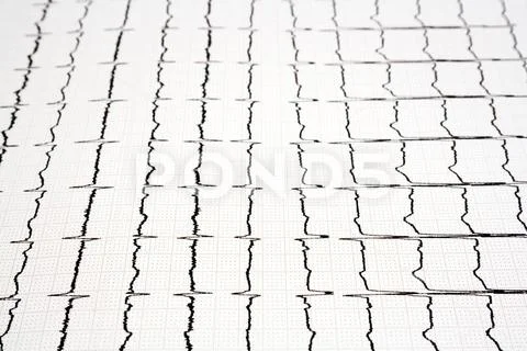 Photograph: EKG graph Close-up image of ECG - EKG graph Copyright ...