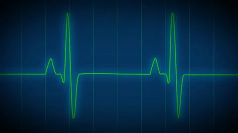 EKG Heart Monitor blue | Stock Video | Pond5