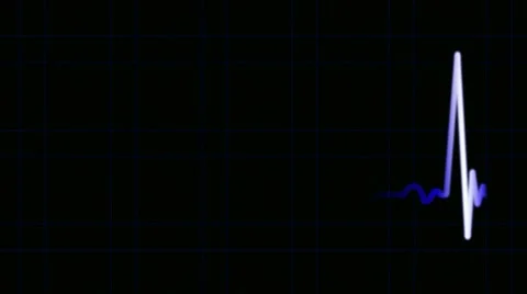 Dying Ecg Echocardiogram Stock Footage ~ Royalty Free Stock Videos | Pond5
