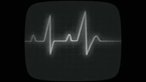 Ekg Heart Monitor goes Flatline | Stock Video | Pond5