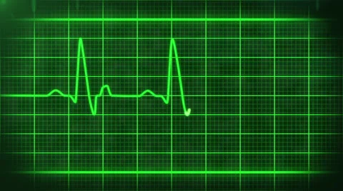 Ekg Monitor Animated Heart Stock Video Footage | Royalty Free Ekg ...