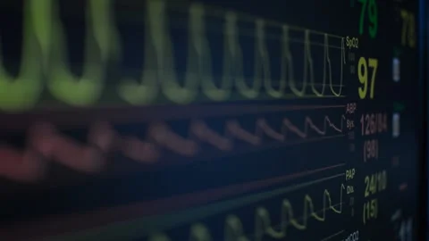 ekg heart monitor for heartbeat pulse mo... | Stock Video | Pond5