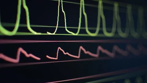 ekg heart monitor for heartbeat pulse mo... | Stock Video | Pond5