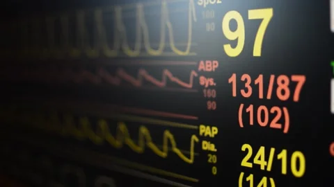 ekg heart monitor for heartbeat pulse mo... | Stock Video | Pond5