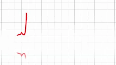 EKG with heart sign | Stock Video | Pond5