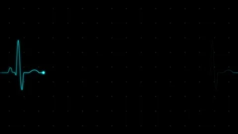 Ekg Animation Heartbeat Stock Video Footage | Royalty Free Ekg ...