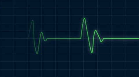 EKG, Heartbeat monitor visual effect, cg... | Stock Video | Pond5