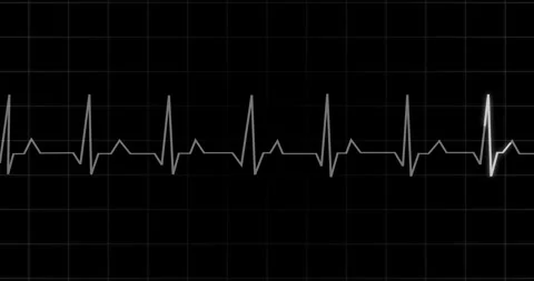 Ekg Animation Heartbeat Stock Video Footage | Royalty Free Ekg ...