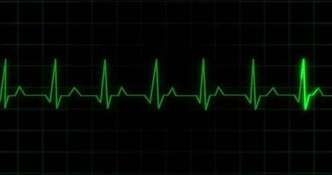 Ekg Animation Heartbeat Stock Video Footage | Royalty Free Ekg ...