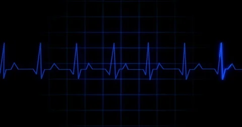 Ekg Animation Heartbeat Stock Video Footage | Royalty Free Ekg ...