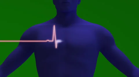 Busted Green Screen Stock Video Footage | Royalty Free Busted Green ...