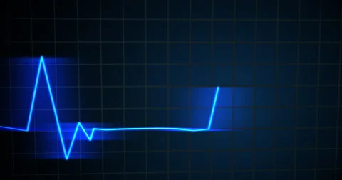 Ekg screen monitor animation blue | Stock Video | Pond5