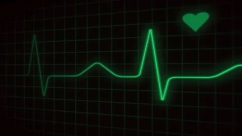 EKG/ECG - Heartbeat Display Monitor - Lo... | Stock Video | Pond5