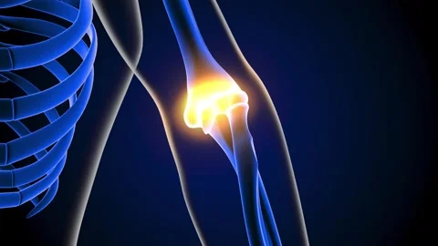 Foot Pain 3D Stock Video Footage | Royalty Free Foot Pain 3D Videos | Pond5