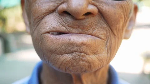 Elderly man biting on cotton gauze after... | Stock Video | Pond5