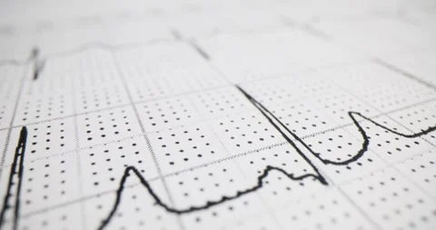 Cardiogram Paper Stock Footage ~ Royalty Free Stock Videos | Pond5