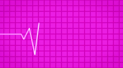 electrocardiogram (EKG or ECG) pink loo... | Stock Video | Pond5
