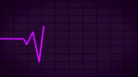 electrocardiogram (EKG or ECG) purple l... | Stock Video | Pond5