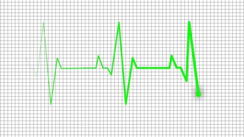 Electrocardiogram Line Animation, A elec... | Stock Video | Pond5