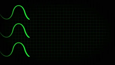 Electrocardiogram oscilloscope waveform ... | Stock Video | Pond5
