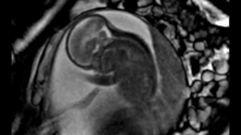 Embryo Stock Footage ~ Royalty Free Stock Videos | Pond5