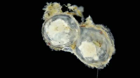 embryo mollusca larva in damaged eggs un... | Stock Video | Pond5