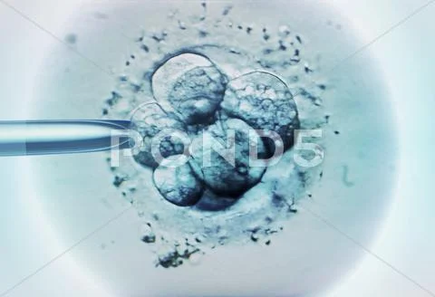 Photograph: Embryo selection for ivf light micrograph #11177537