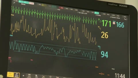 Heart Rate Monitor Stock Footage ~ Royalty Free Stock Videos | Pond5