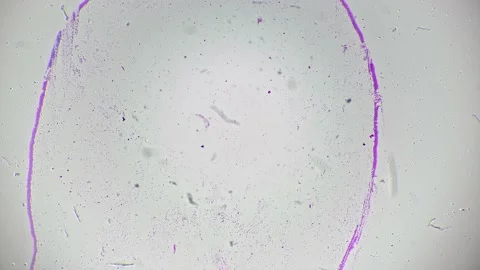 Escherichia coli smear under microscope ... | Stock Video | Pond5