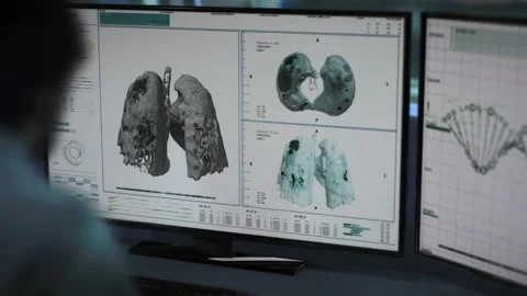 Lung Lung Lung Stock Videos – Royalty-Free HD & 4K Videos | Pond5