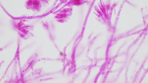 Examination of fungal spores under a mic... | Stock Video | Pond5