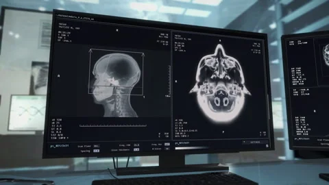 Examining the head imaging data to locat... | Stock Video | Pond5