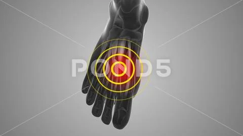 Extensor digitorum longus tendon discomfort that trigger pain: Royalty ...