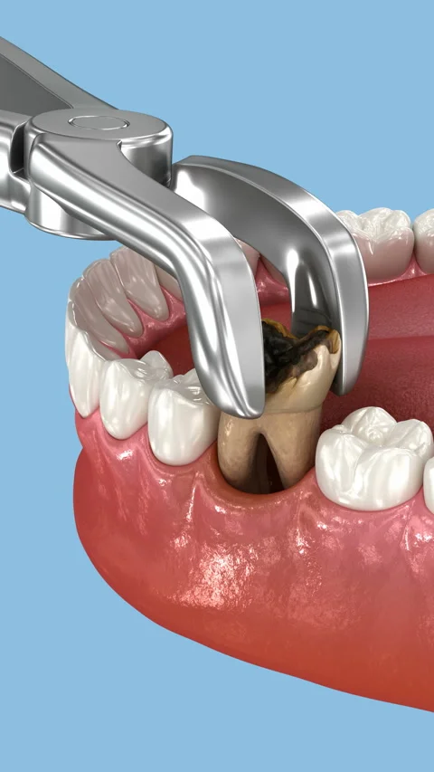 Dental Alignment Animation Stock Videos – Royalty-Free HD & 4K Videos ...