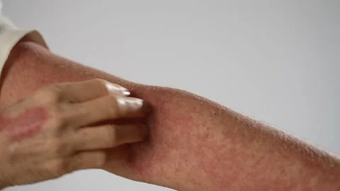 Extreme closeup of woman showing skin ra... | Stock Video | Pond5