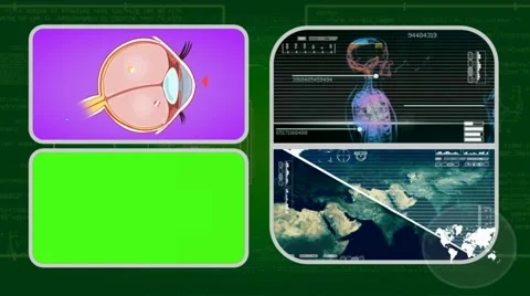 Eye - Analysis in software - examination... | Stock Video | Pond5