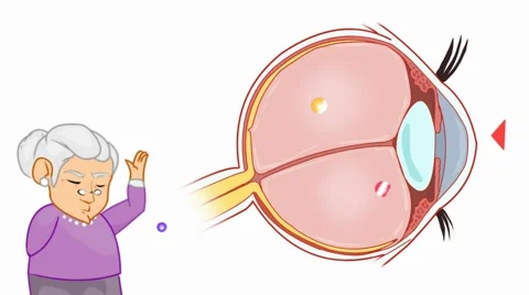 Eye Anatomy - Vector Cartoon - White Ba... | Stock Video | Pond5